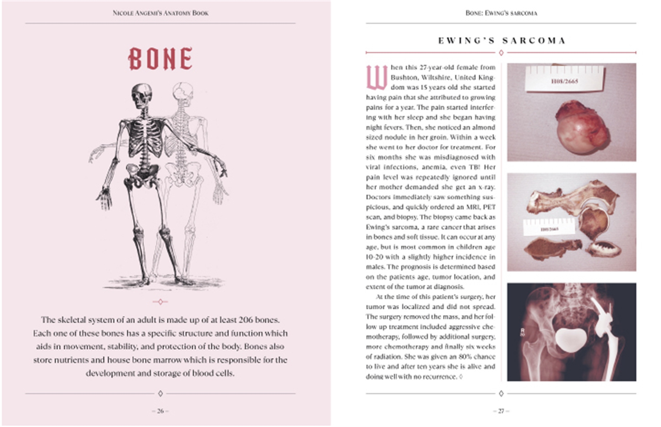Nicole Angemi's Anatomy Book, A Catalog of Familiar, Rare, and Unusual ...
