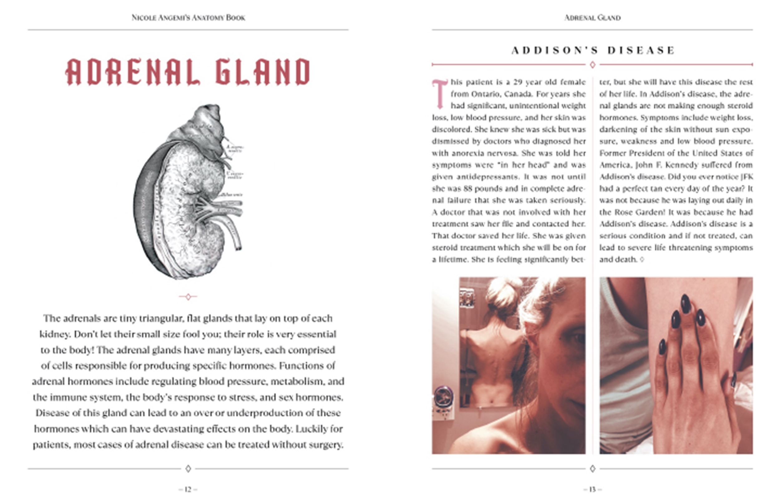 Nicole Angemi's Anatomy Book, A Catalog of Familiar, Rare, and Unusual ...