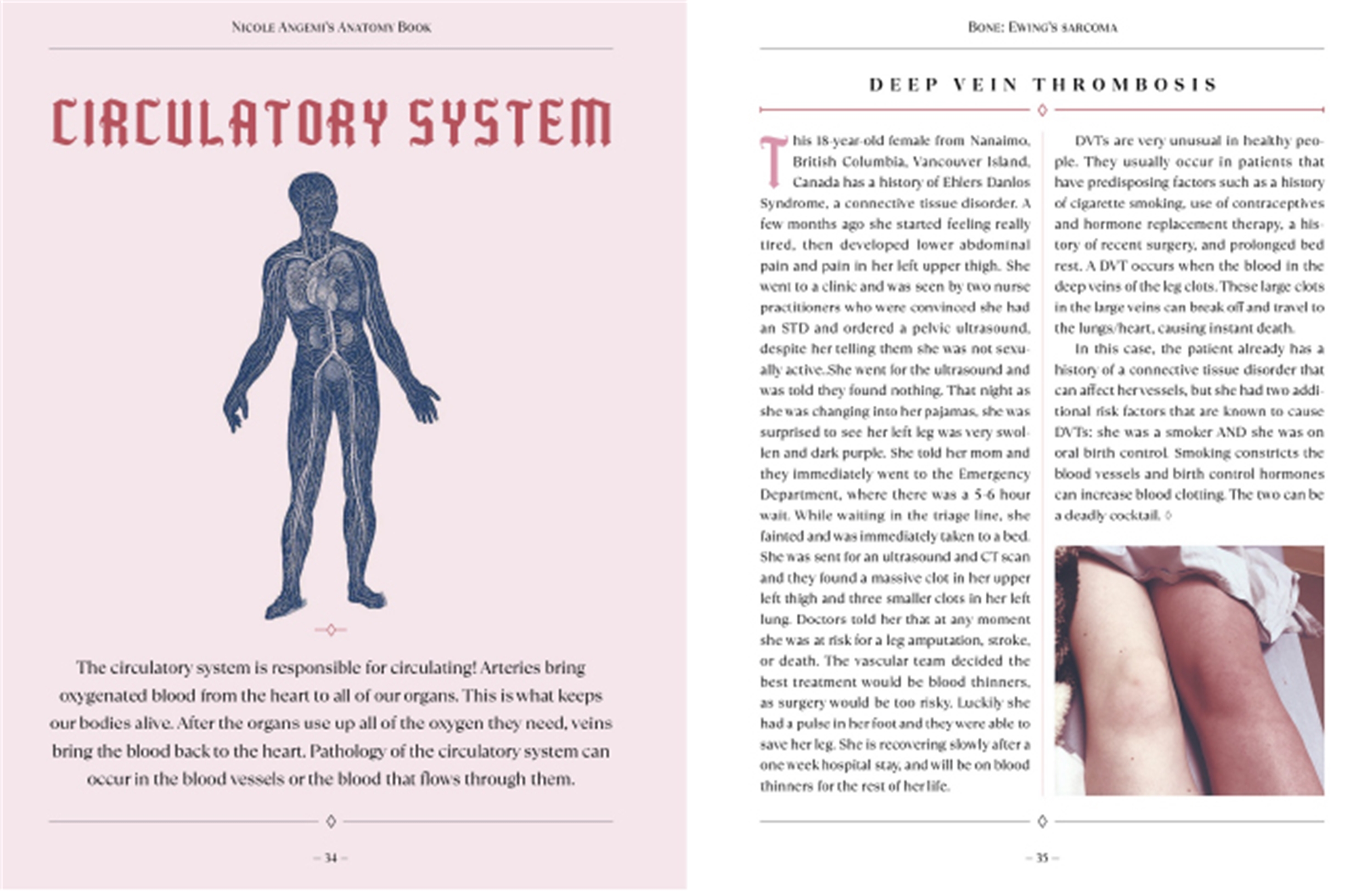 Nicole Angemi's Anatomy Book, A Catalog of Familiar, Rare, and Unusual ...